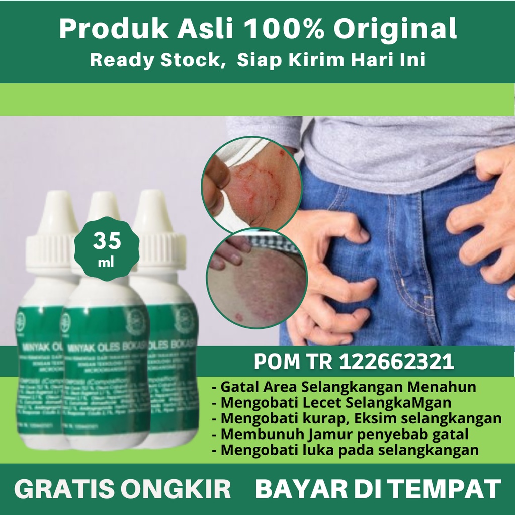 Jual Obat Tinea Cruris Rasa Gatal di Selakangan Akibat Infeksi Jamur ...