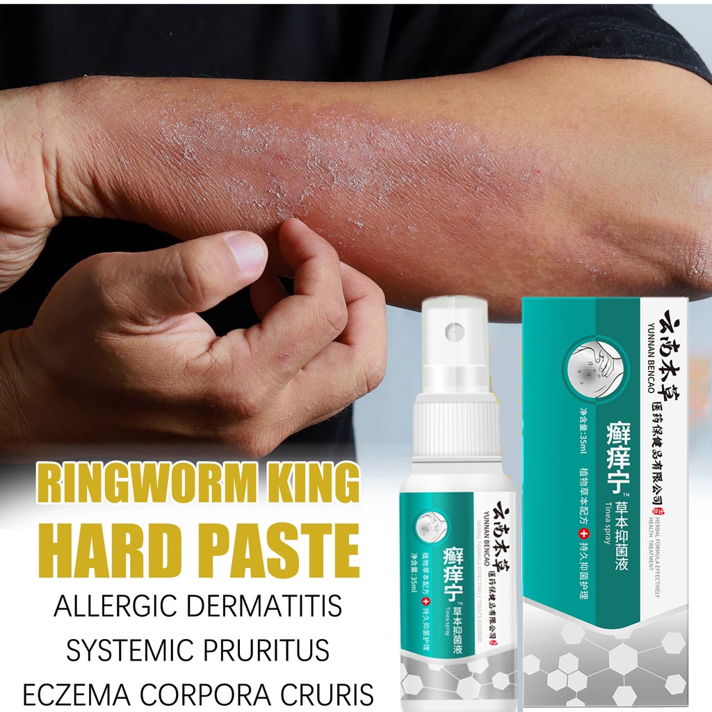 Jual Salep Kulit Salep Eksim Salep Psoriasis Salep Gatal Paling Ampuh ...
