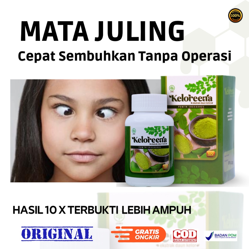 Jual Obat Mata Juling - Obat Strabismus - Obat Mata Jereng - Obat Mata ...