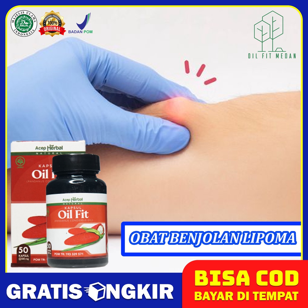 Jual Oil Fit Herbal Sari Buah Merah Obat Benjolan Lipoma, Benjolan ...
