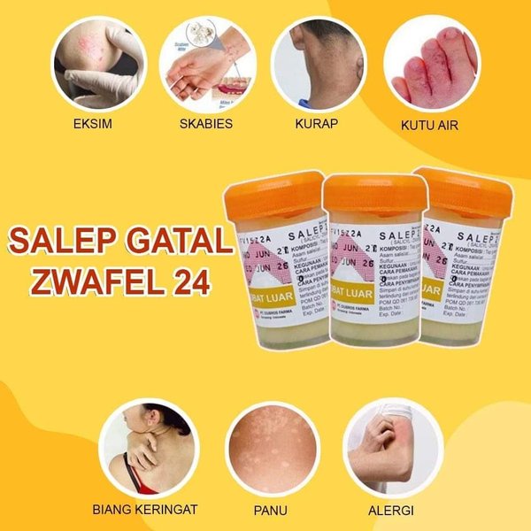 Jual [Cod] Salep Cina Obat Gatal Panu Paling Ampuh Zwafel 24 Original ...