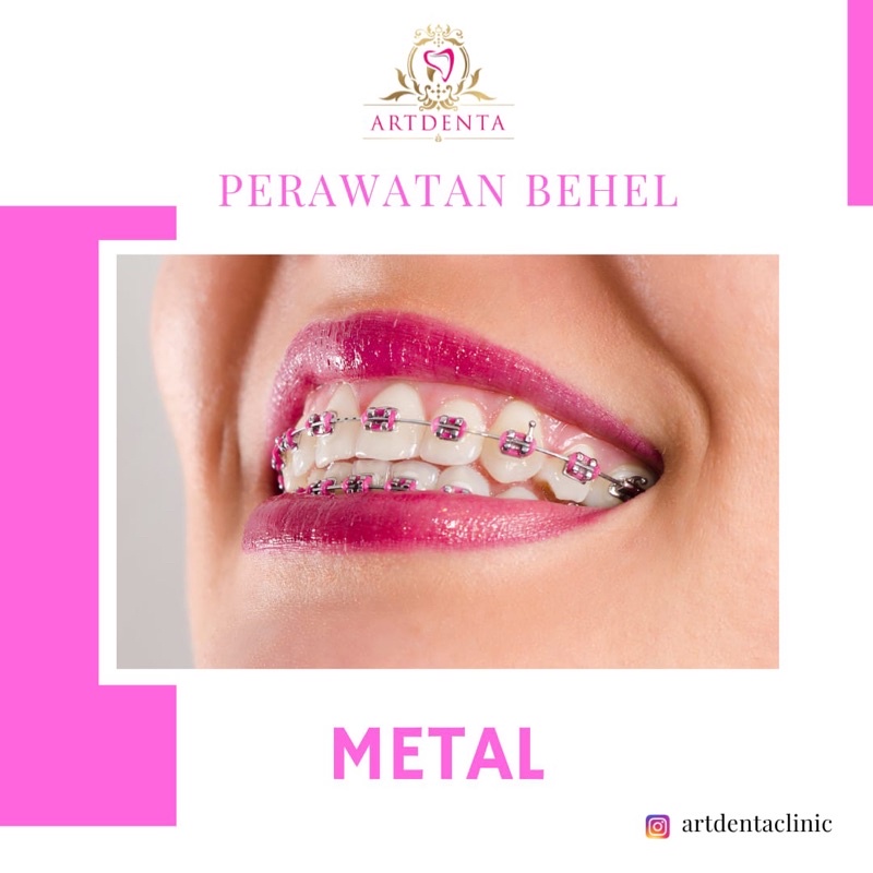 Jual PROMO BEHEL METAL | Shopee Indonesia