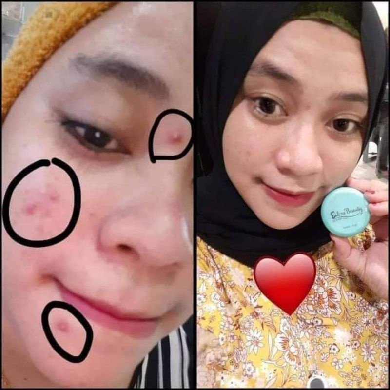 Jual Eliza beauty cream 3 pot lebih hemat ( agen resmi tangerang ...