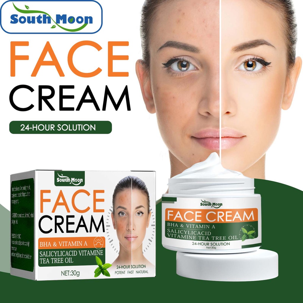 Jual South Moon Acne Cream Acne Care Treatment Serum Acne Spot Drying ...