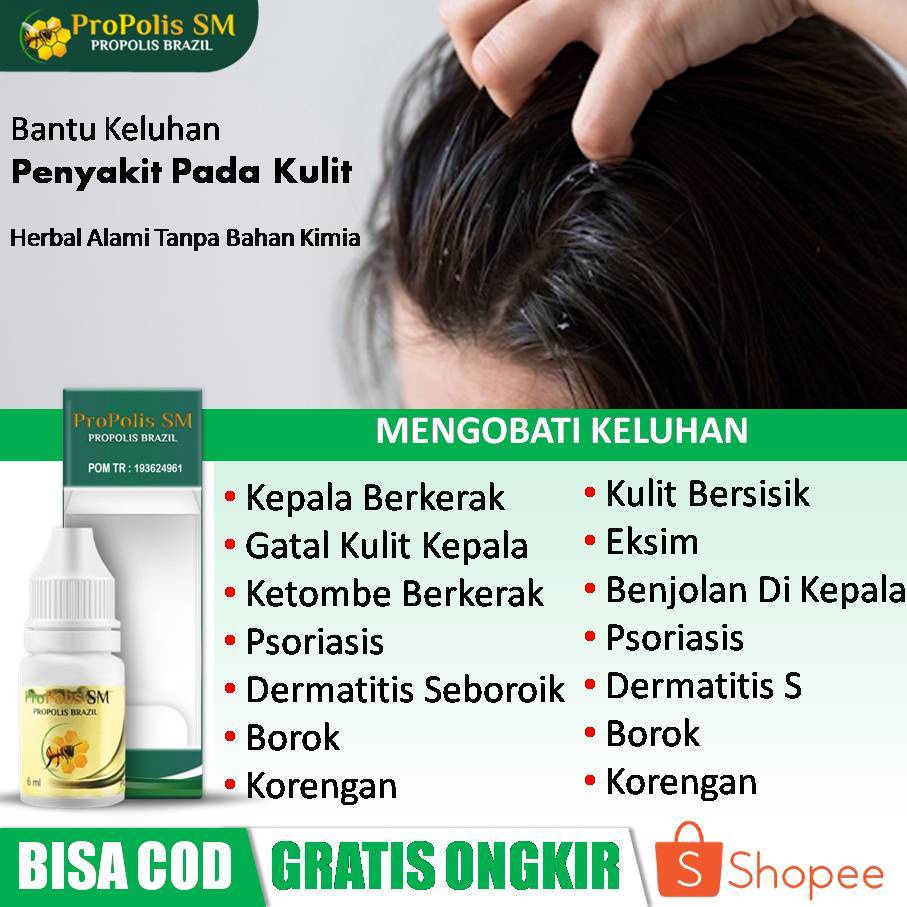 Jual Obat Oles Gatal Kulit, Gatal Kulit Kepala, Psoriasis, Ketombe Berkerak, Borok Di Kepala ...