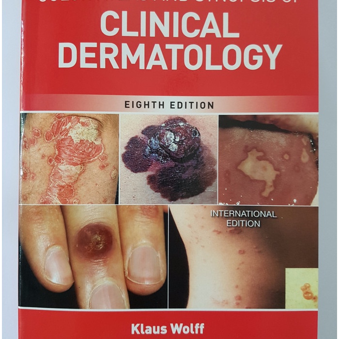 Jual Buku Kedokteran Fitzpatrick Color Atlas & Synopsis Clinical Dermatology 8Ed Original ...