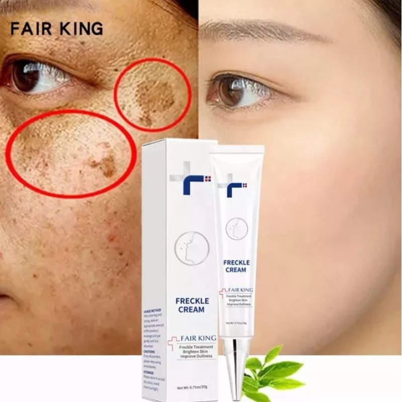 Jual FAIR KING EFFECTIVE FRECKLE CREAM REMOVE DARK SPOT WHITENING CREAM FADE ACNE MELASMA 20g ...
