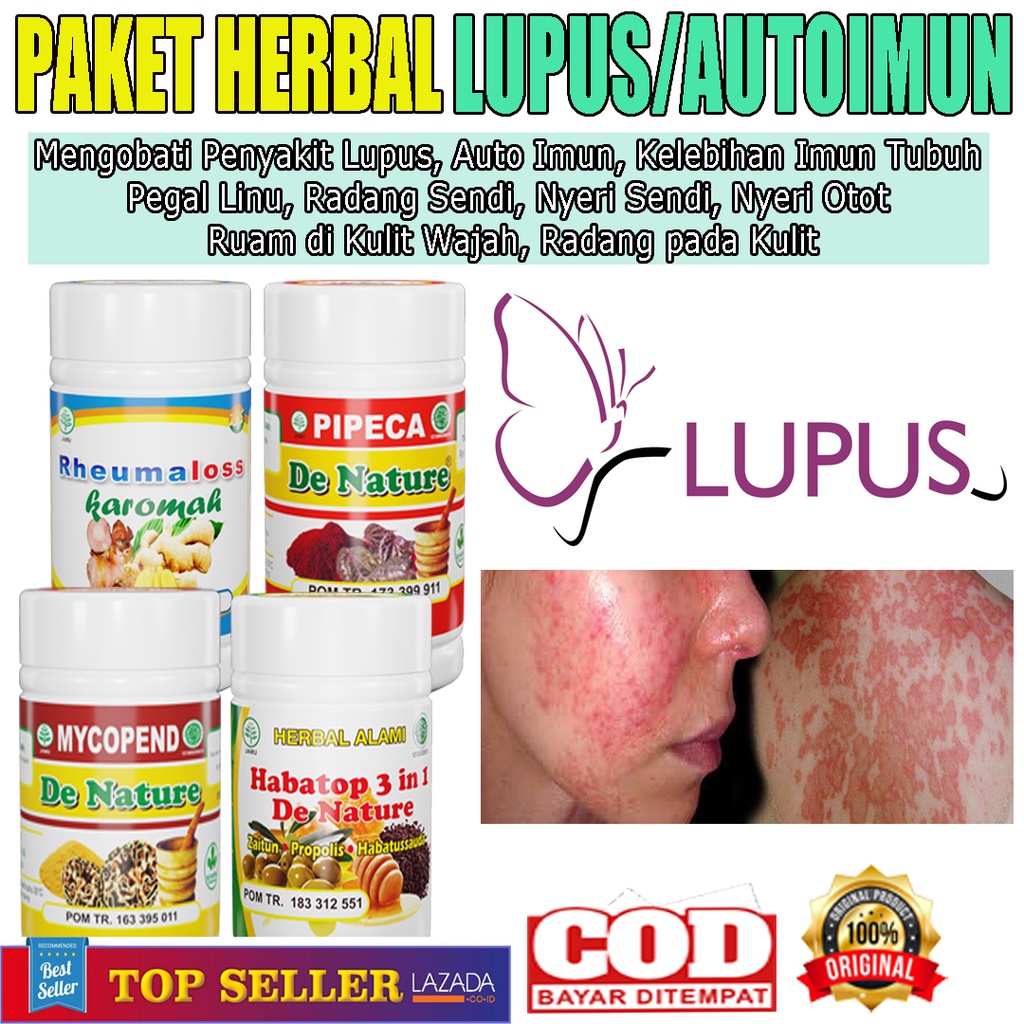 Jual OBAT LUPUS HERBAL PALING AMPUH-OBAT AUTOIMUN-OBAT RUAM DIKULIT ...