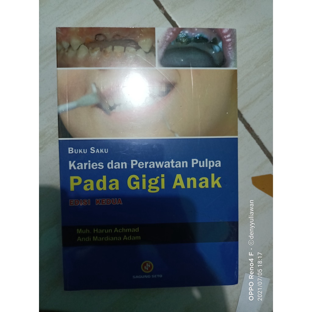 Jual Belum Ganti Harga - Buku ORIGINAL - BUKU SAKU KARIES DAN PERAWATAN ...