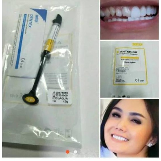 Jual limited STOCK!Komposit Dentex Anterior Composite Veneer Extra White DX Esthetic XW atau EXW ...