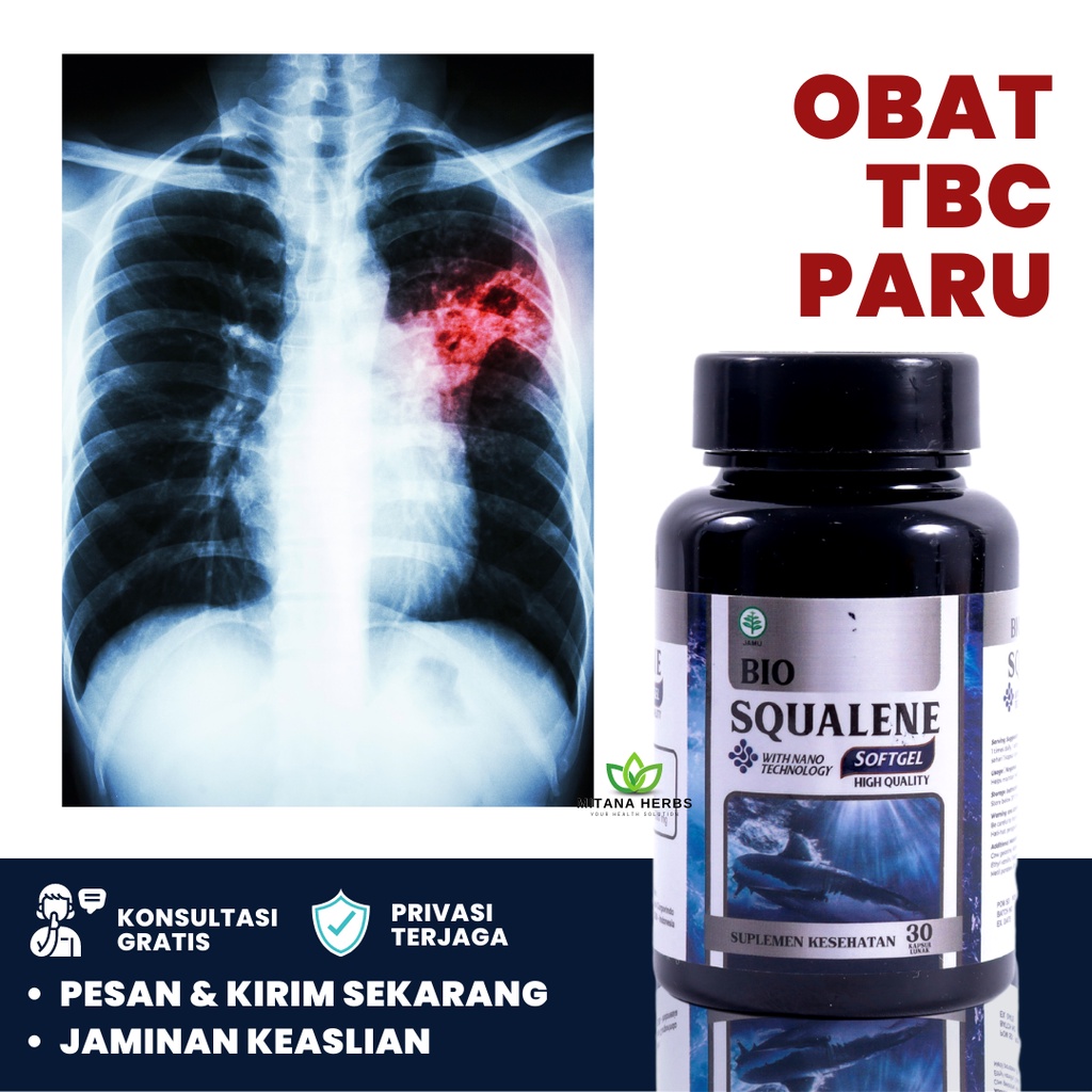 Jual Mitana Herbal - Obat Tbc Paru - Obat Tbc Anak - Obat Tbc Kelenjar ...