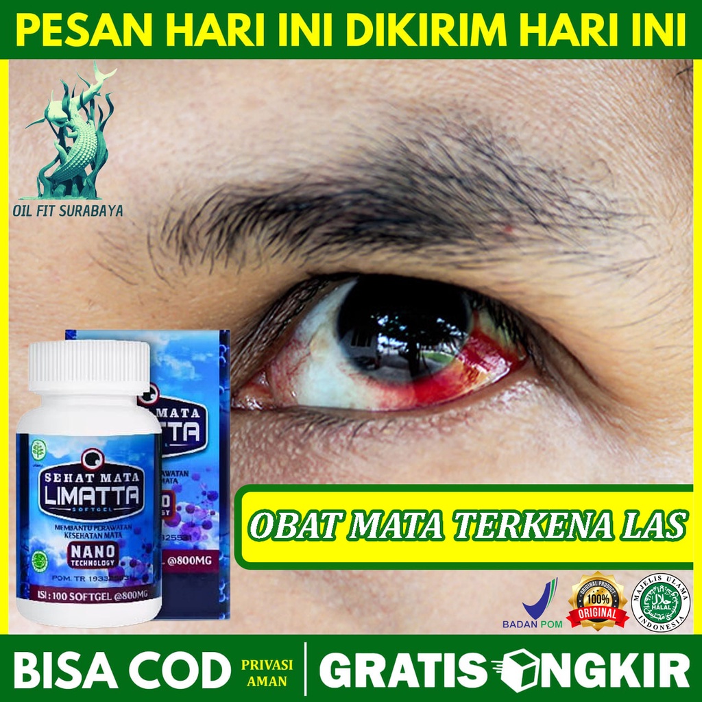 Jual Obat Mata Terkena Las Habis Ngelas Mata Sakit Kena Asap Las ...