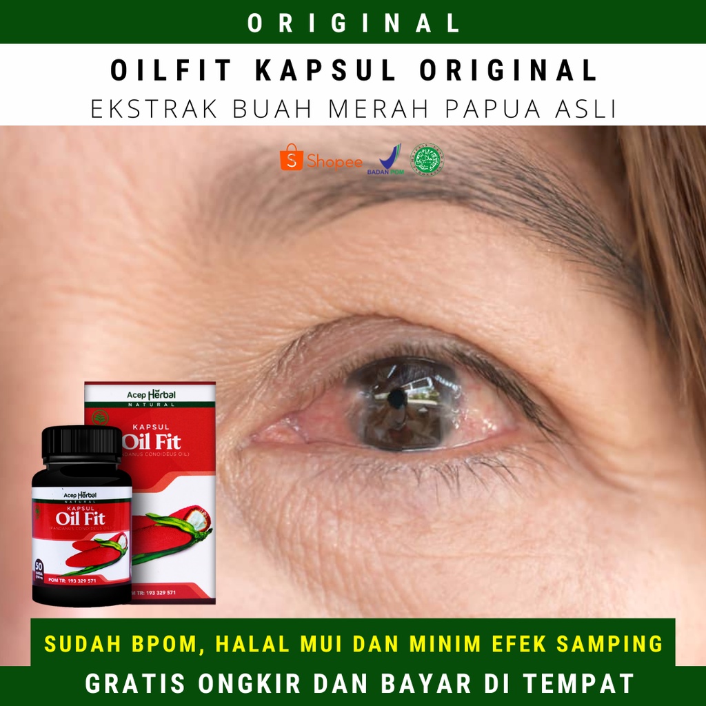 Jual Obat Mata Berlemak, Mata Katarak, Lamad Mata, Mata Buram, Mata ...