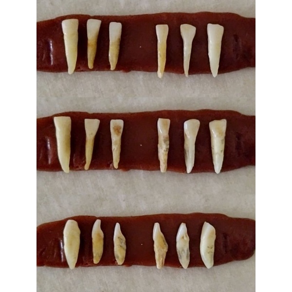 Jual Paket gigi SL splinting/ set C - C RB/ gigi insisiv / gigi molar ...