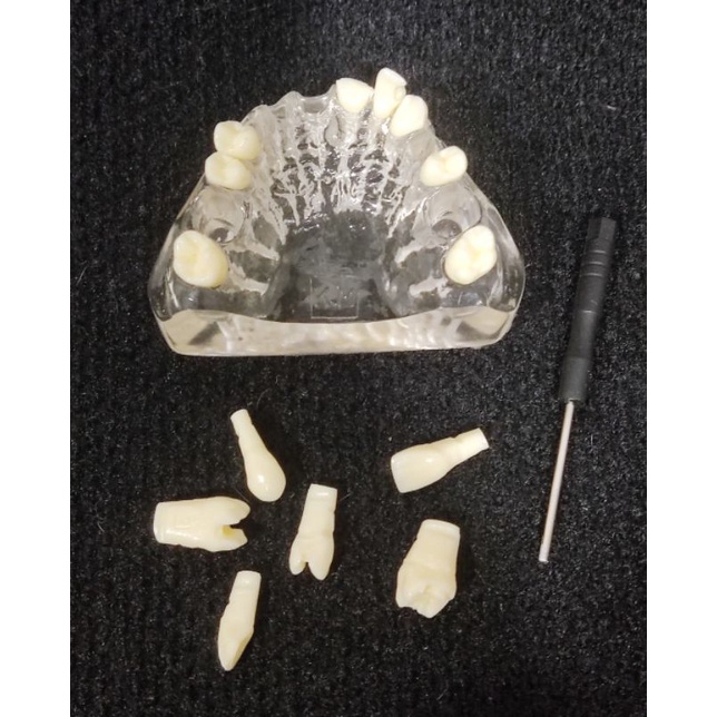 Jual Duradent model gigi Dental Study Model Phantom Gigi bisa di lepas ...