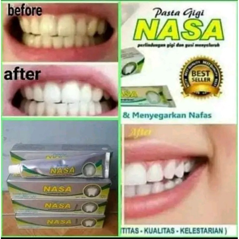 Jual PASTA GIGI NASA ORIGINAL, | Shopee Indonesia