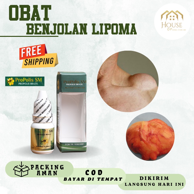Jual Obat benjolan lipoma,Obat benjolan lemak (Lipoma) Benjolan di ... Jual Obat benjolan lipoma,Obat benjolan lemak (Lipoma) Benjolan di ...