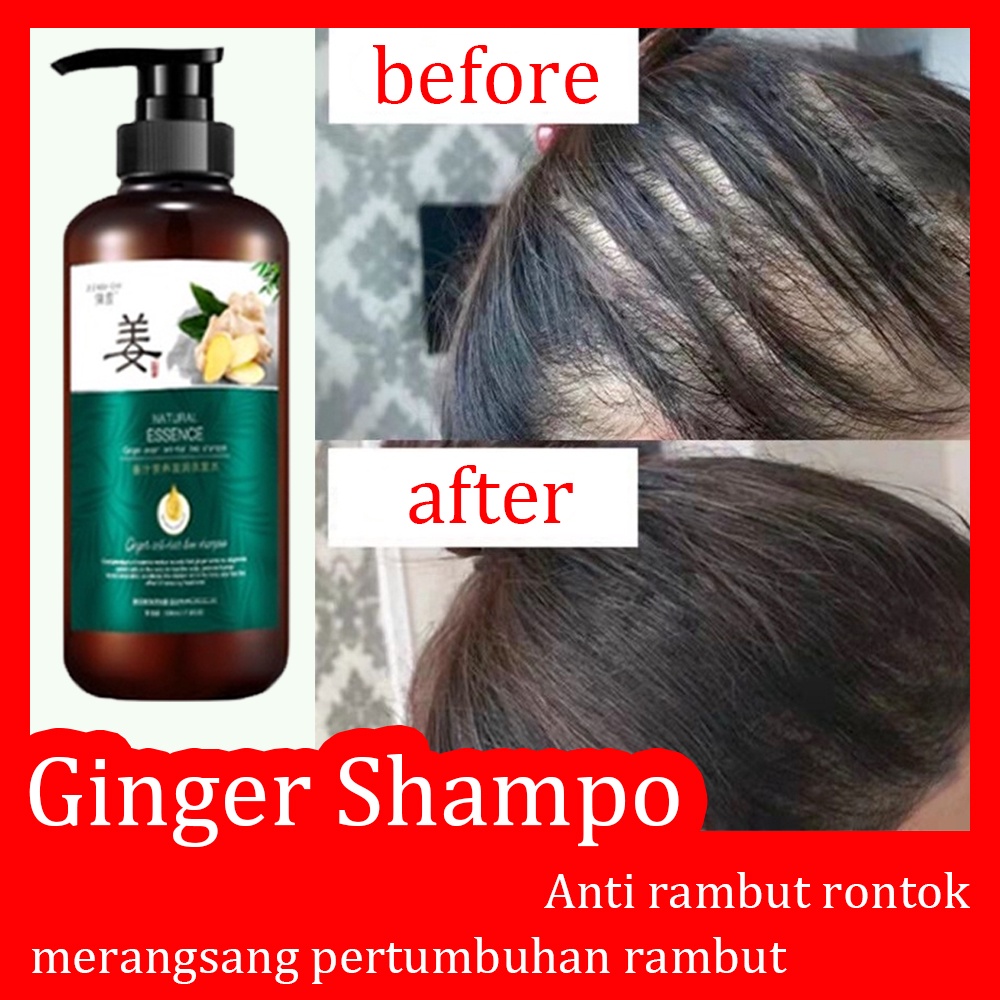 Jual sampo anti-rambut rontok /sampo anti ketombe kontrol minyak Shampo /hair care treatment ...