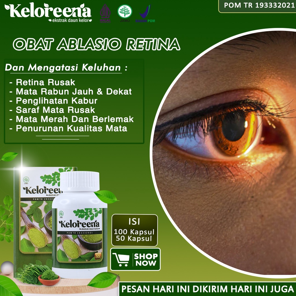 Jual Obat Ablasio Retina Pterygium Glaukoma Retinopati Diabetik Saraf ...