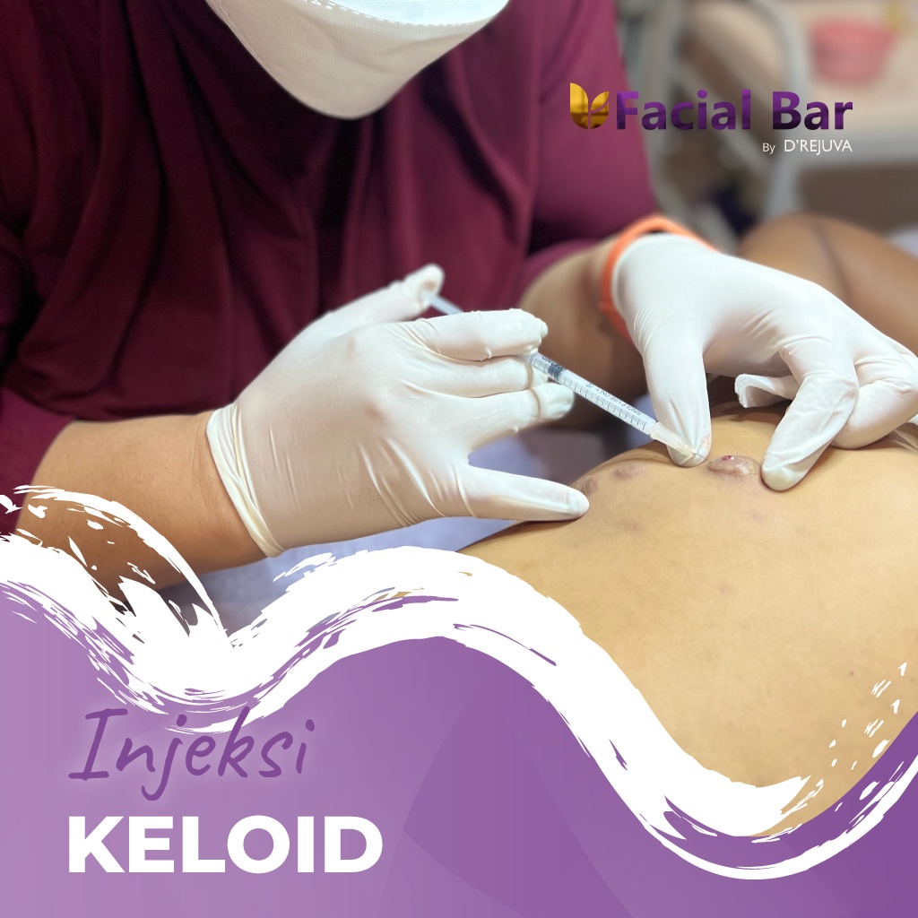 Jual Injeksi Keloid | Shopee Indonesia