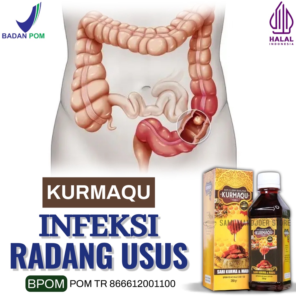 Jual Obat Infeksi & Radang Usus, Nyeri & Susah BAB, BAB bercampur darah ...