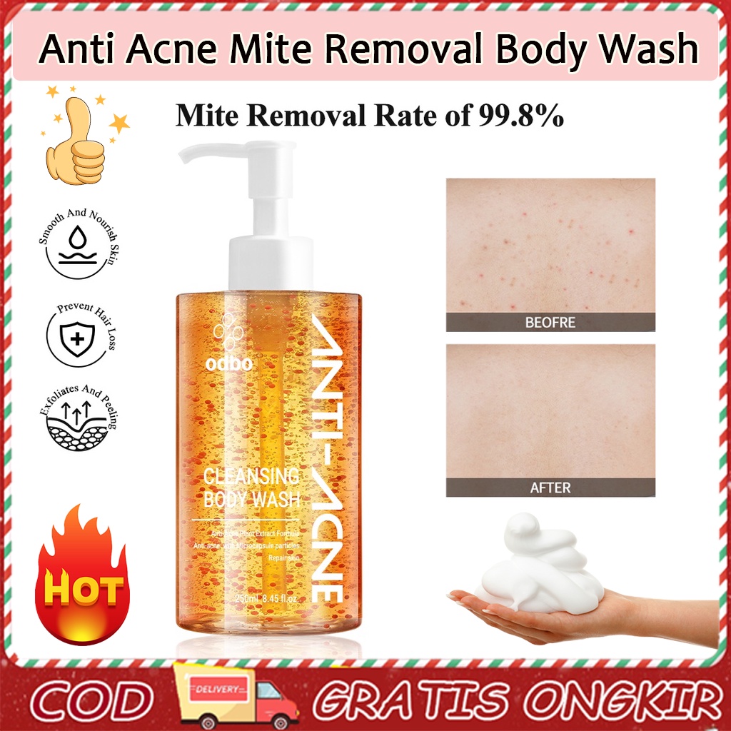Jual Anti Acne Mite Removal Body Wash Brightening Cleansing Acne Care Body Wash 250ml Body Scrub ...