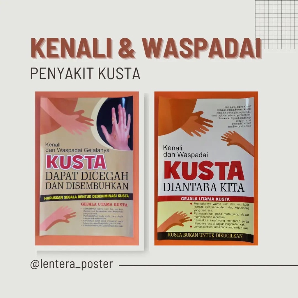 Jual Paket poster kusta BONUS flyer kusta, Poster Kusta dapat dicegah ...