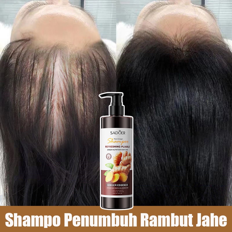 Jual Shampo Jahe 500ml Shampo Penumbuh Rambut Tebal Anti Ketombe Gatal ...