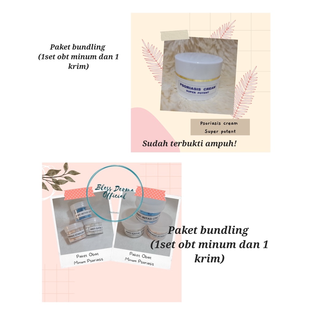 Jual PAKET BUNDLING (1SET OBAT MINUM&1KRIM PSORIASIS SUPER POTENT ...