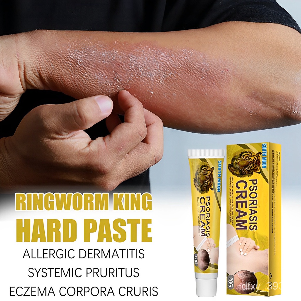 Jual Salep gatal Salep Eksim Salep kulit Krim psoriasis paling ampuh ...