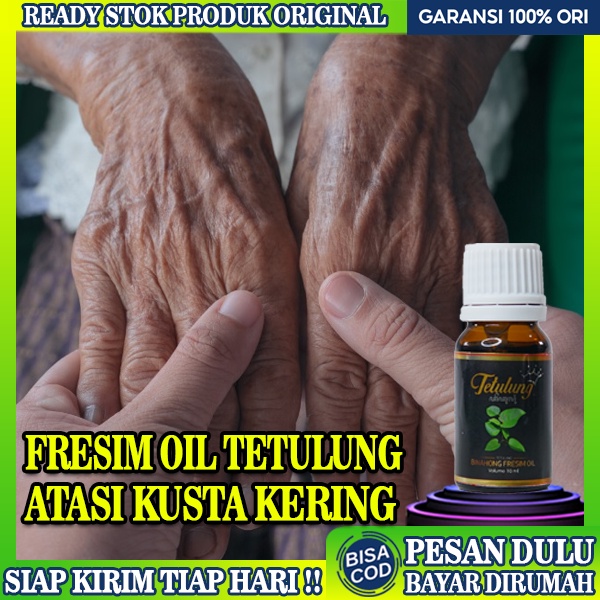 Jual Obat Ampuh Kusta Kering Penyakit Kusta Kering Basah Fresim Oil ...