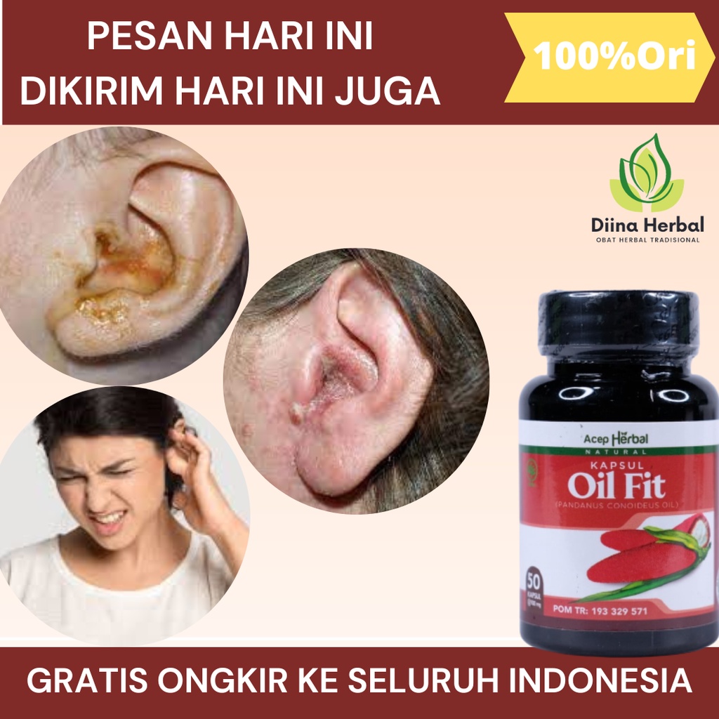 Jual Obat Radang Telinga, Obat Telinga Otitis Media, Obat Peradangan ...