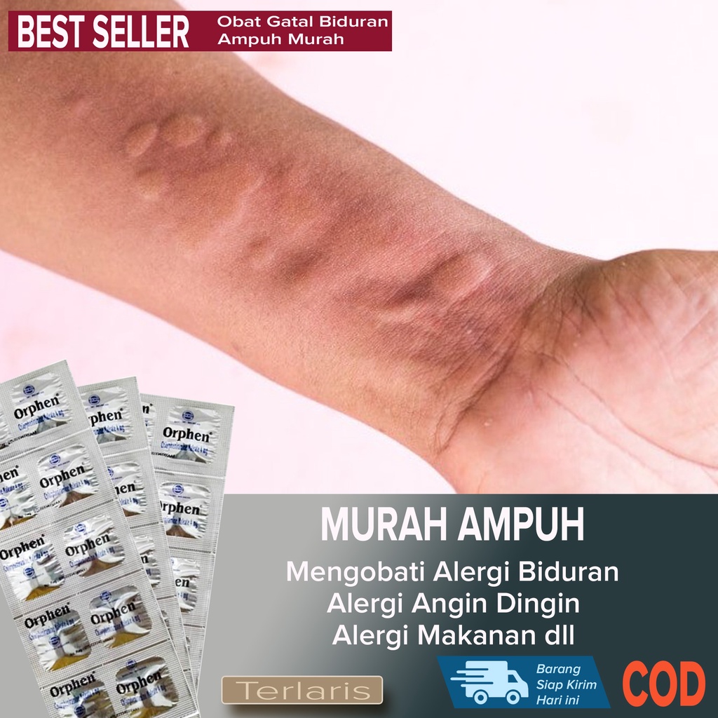 Jual Obat gatal Biduran MURAH AMPUH mengobati Gatal Alergi Cuaca Alergi ...