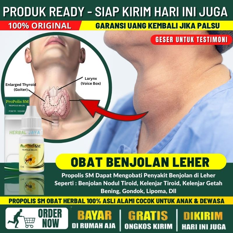 Jual Obat Benjolan di Leher 100% Herbal Alami, Obat Lipoma ...
