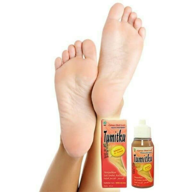 Jual TUMITKU Obat Herbal Mengatasi Kaki Pecah isi 30ml | Shopee Indonesia