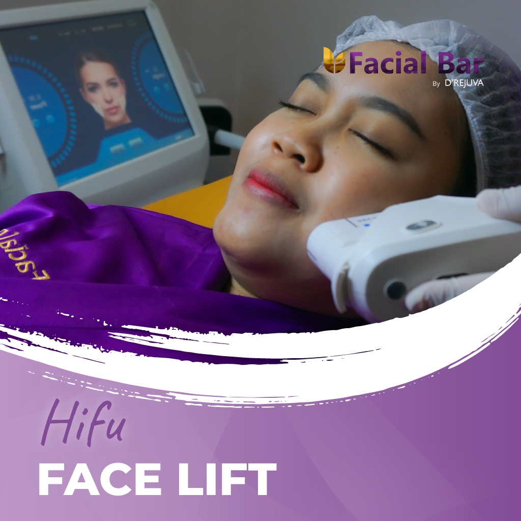 Jual Hifu Face Lift | Shopee Indonesia