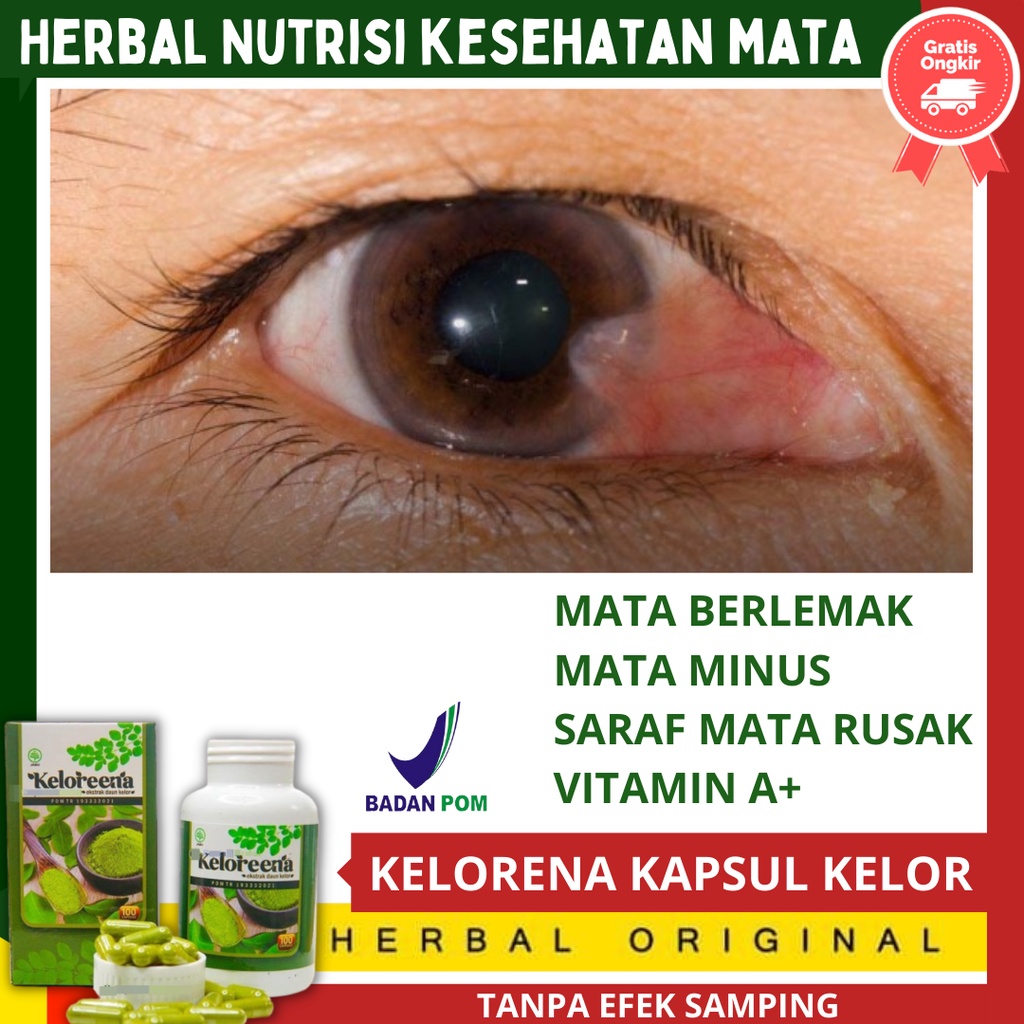 Jual Obat Untuk Didalam Mata Hitam Ada Cairan Putih, Bintik Putih Pada ...
