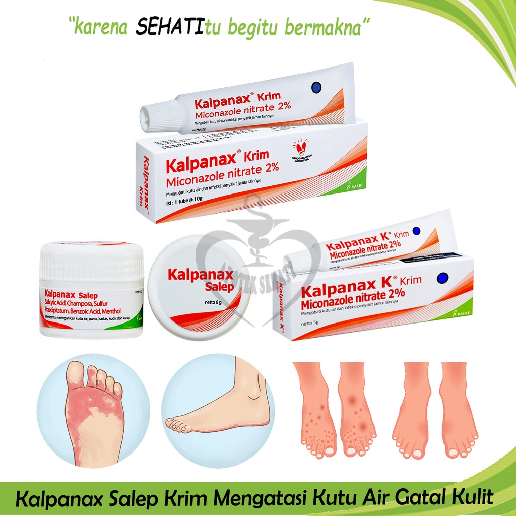 Jual KALPANAK KRIM 5 GRAM Miconazole Jamur Panu Kadas Kurap Kutu Air ...