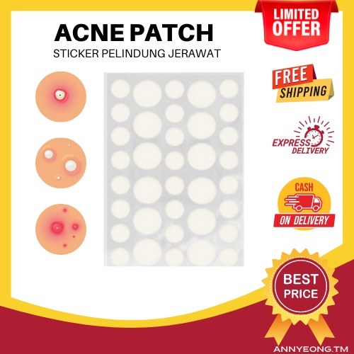 Jual [36 PCS] Acne Patch Obat Jerawat / Sticker Jerawat/ Pelindung ...