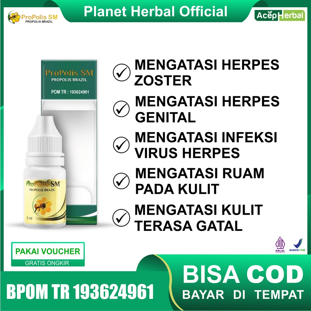 Jual Obat Herpes Herbal Pengering Luka Herpes Zoster Genital Propolis ...