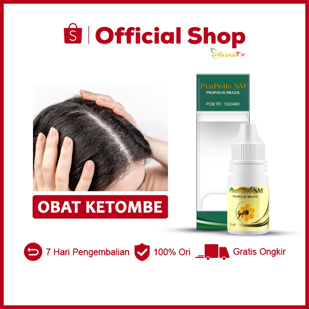 Jual Obat Ketombe Basah Kering dan Berkerak Penghilang Ketombe Parah dan Kulit Mati di Kulit ...