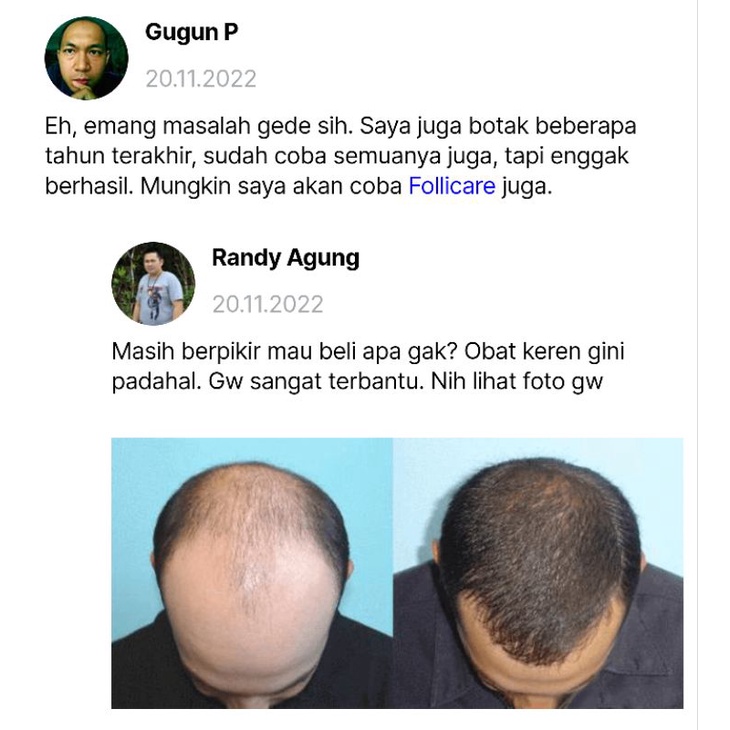 Jual FOLLICARE ASLI SERUM PENUMBUH RAMBUT MENGATASI RONTOK 100ML ...