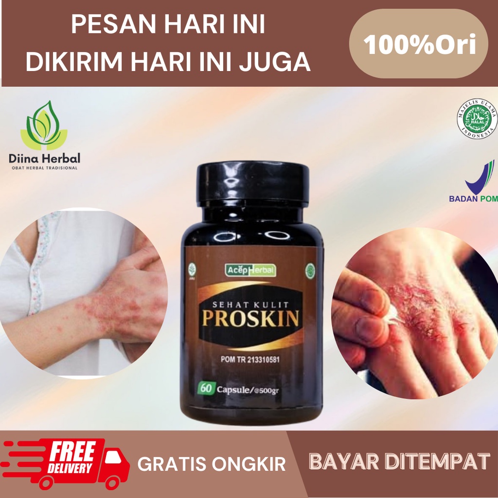 Jual Obat Kudis Scabies Manusia, Obat Gatal Scabies, Obat Budug Kudis ...