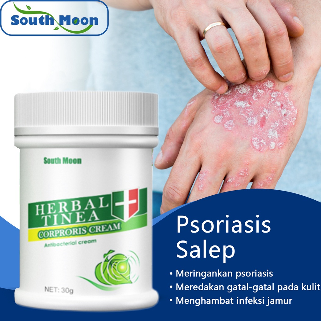 Jual Salep gatal Salep Eksim Salep kulit Krim psoriasis paling ampuh ...
