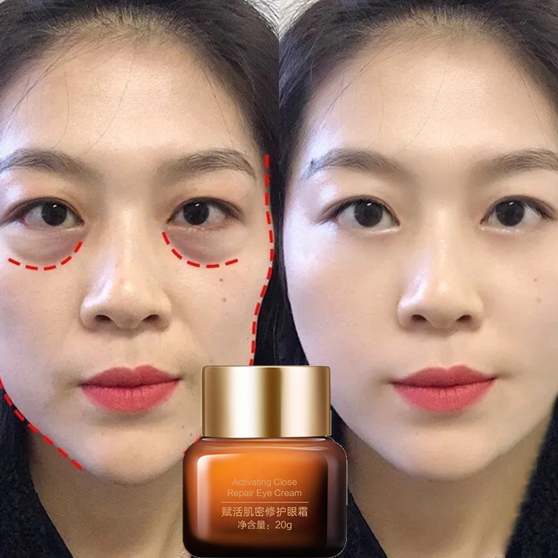 Jual Eye Cream activating close repair eye cream 20g Eye Bag Removal ...