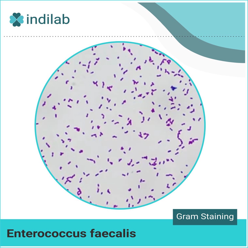 Jual Kultur Isolat murni Enterococcus faecalis | Shopee Indonesia