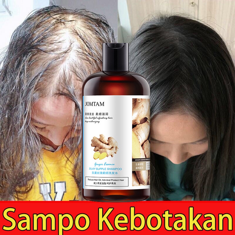 Jual [100% asli] Shampo Penumbuh Rambut Cepat Serum Rambut Rontok Botak ...