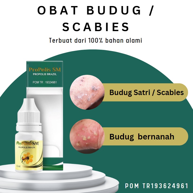 Jual Kaka Herbal - Obat Budug, Scabies, Buduk, Gudik / Gudig, Obat ...