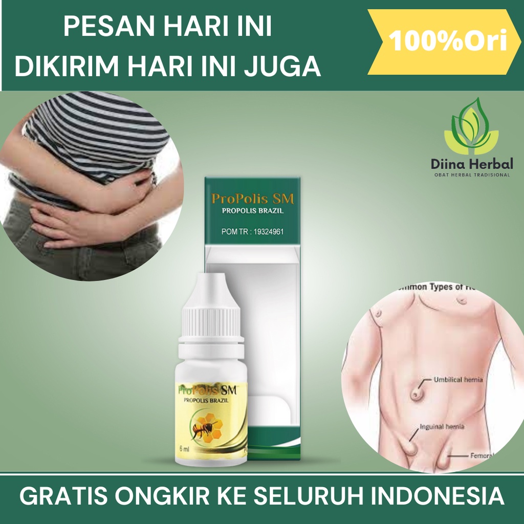 Jual Obat Hernia Turun Berok Dewasa Dan Anak, Obat Hernia Turun Berok ...