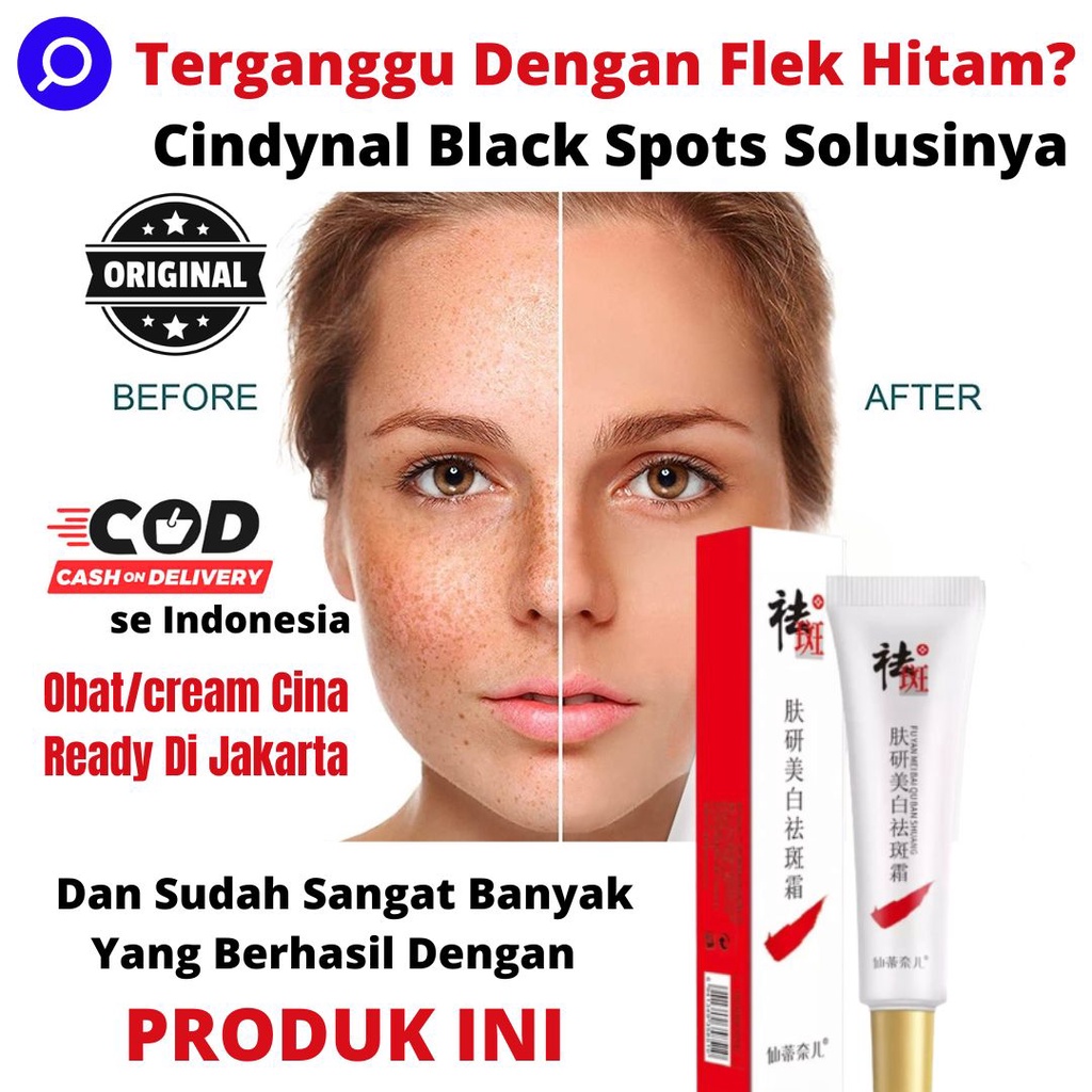 Jual Cindynal Cream Flek Hitam Pemutih Wajah BPOM Krim Cina Ampuh | Shopee Indonesia